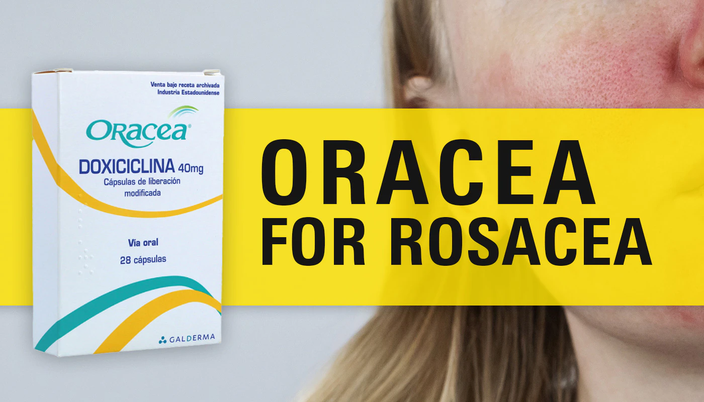 Oracea: Your Guide to Rosacea Treatment