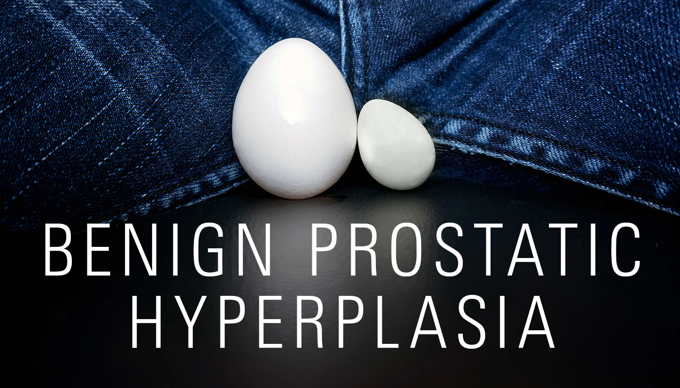 Benign Prostatic Hyperplasia