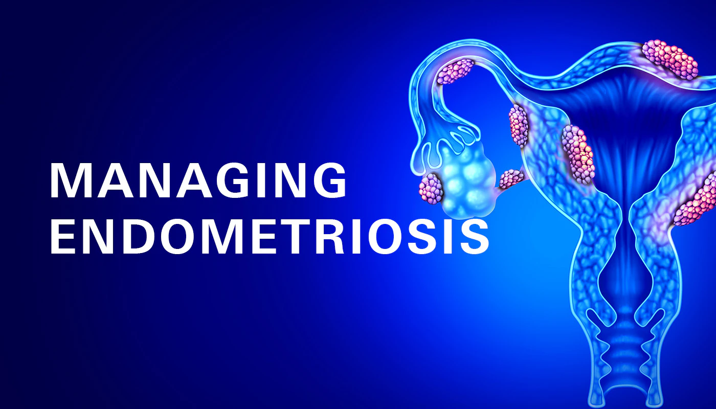 Managing Endometriosis: Navigating the Path to Diagnosis and Treatment