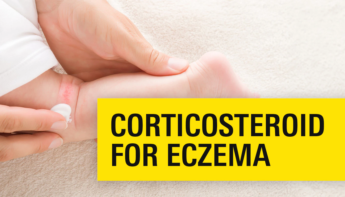 Choosing the Right Corticosteroid for Your Eczema