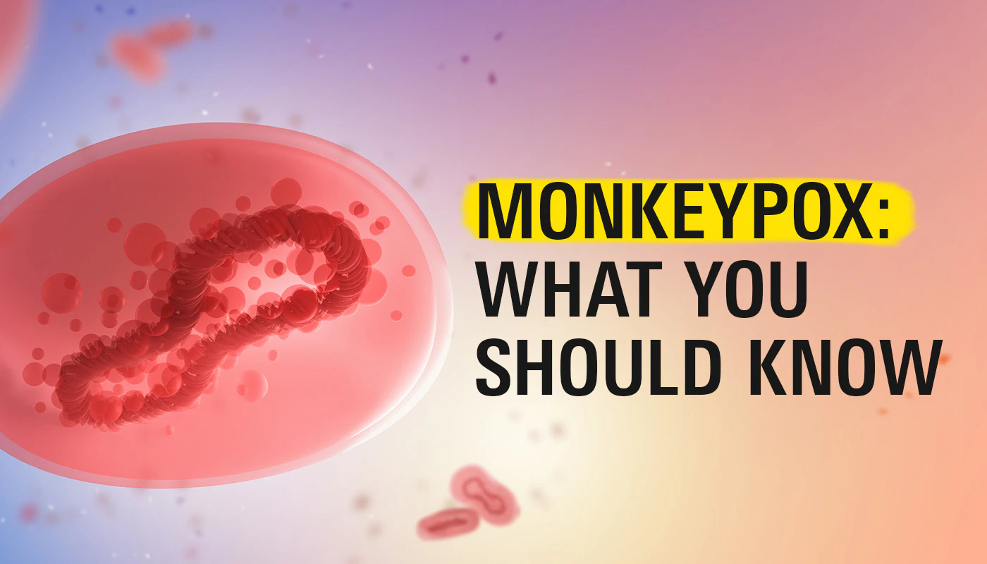 Monkeypox: What You Should Know